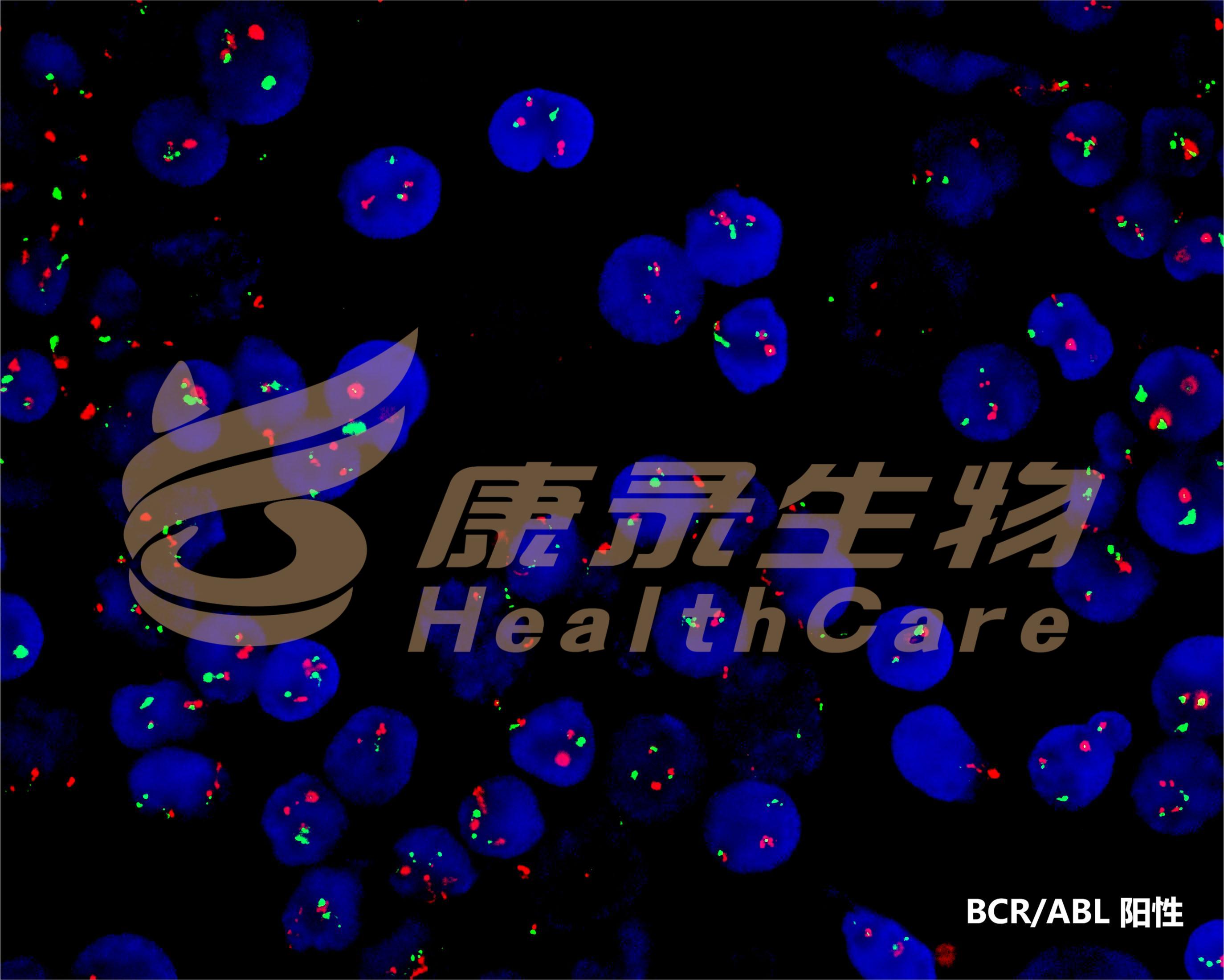 BCR/ABL融合基因检测试剂盒（荧光原位杂交法）-武汉康录生物技术股份有限公司