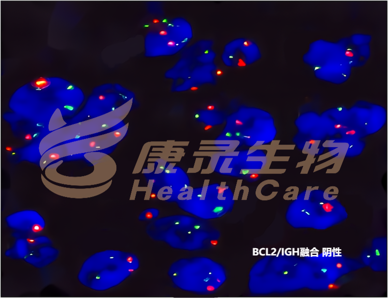 BCL6/MYC/IGH/[BCL2/IGH]基因探针试剂（荧光原位杂交法）-BCL2/IGH融合-武汉康录生物技术股份有限公司