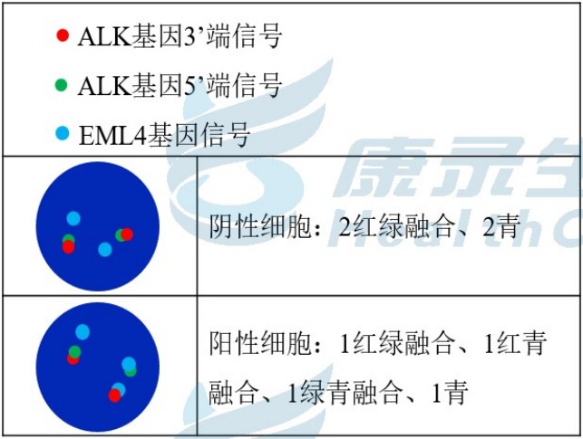 ALK/EML4融合基因探针试剂（荧光原位杂交法）-武汉康录生物技术股份有限公司